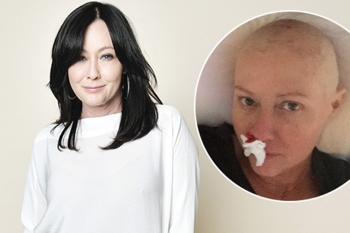 Shannen Doherty spoke about the fight against the last stage of cancer ...